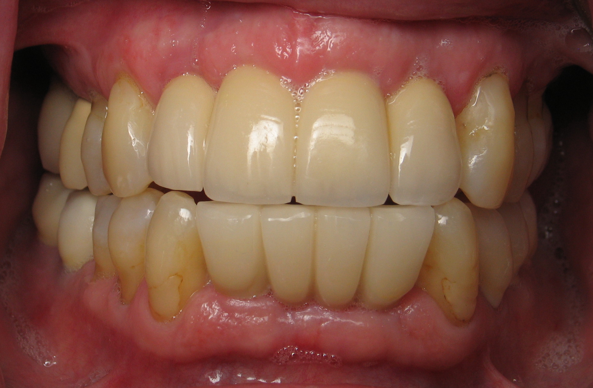 Smile Gallery | Ramsey Amin, DDS