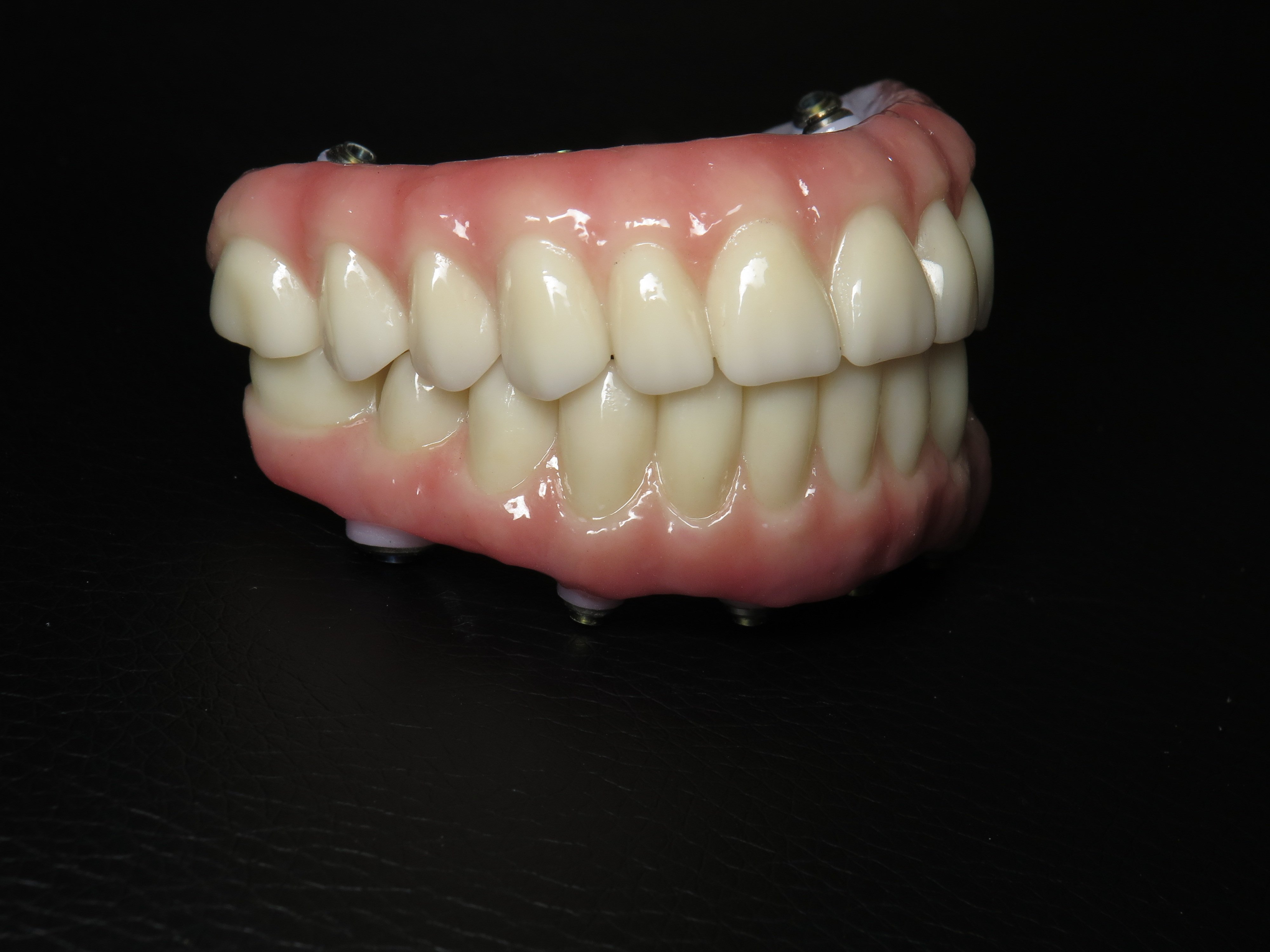 All On Dental Implants With Prettau Solid Zirconia Dental Implant ...